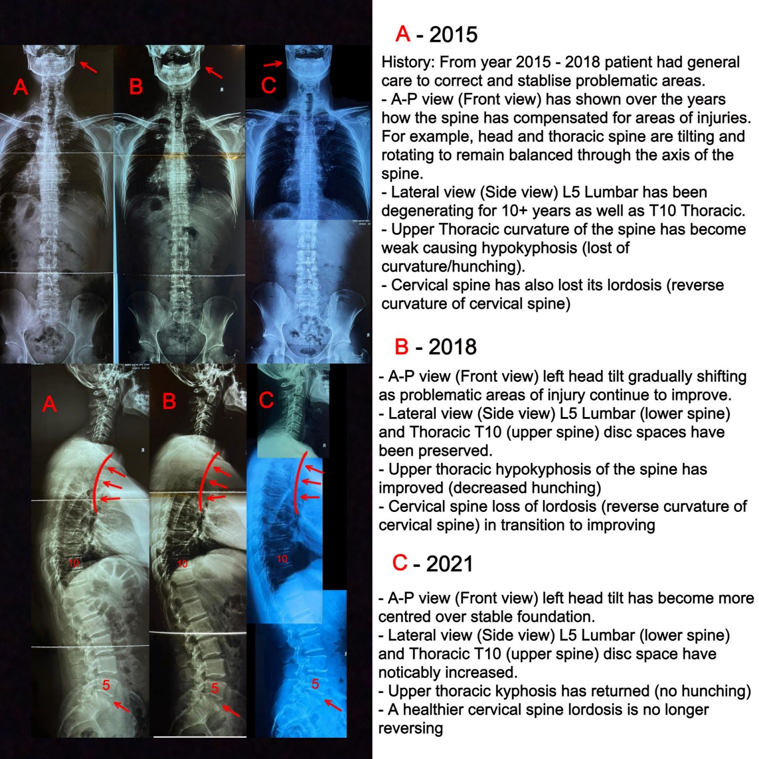 The Significance of Gonstead Chiropractic for Spinal Healthcare - A ...